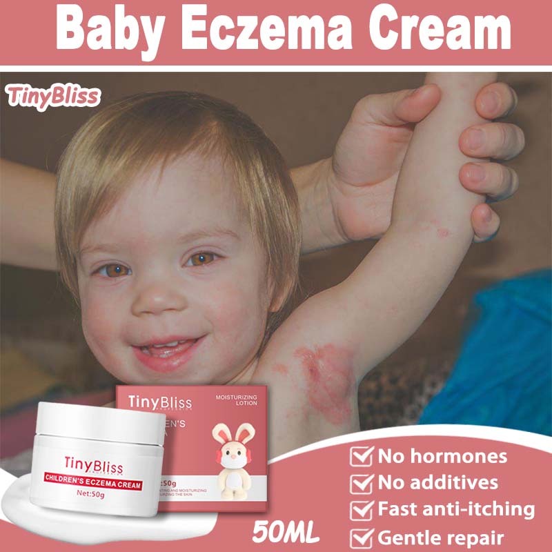 Tinybliss Baby Eczema Cream 50g Antiseptic Rashes Nappy Rash Cream-All ...