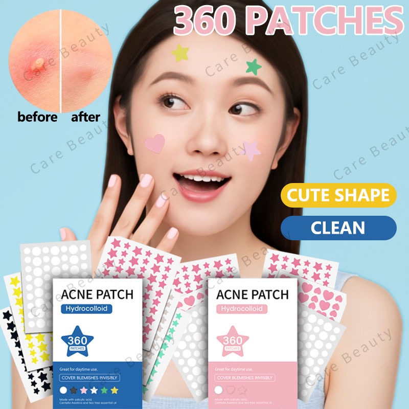 360Pcs Acne Pimples Patch Star Heart-Shape Circle Hydrocolloid Colorful ...