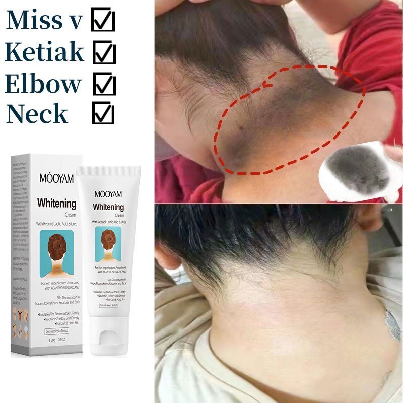 Neck Whitening Cream Niacinamide Intense Bleaching Body Underarm Dark ...