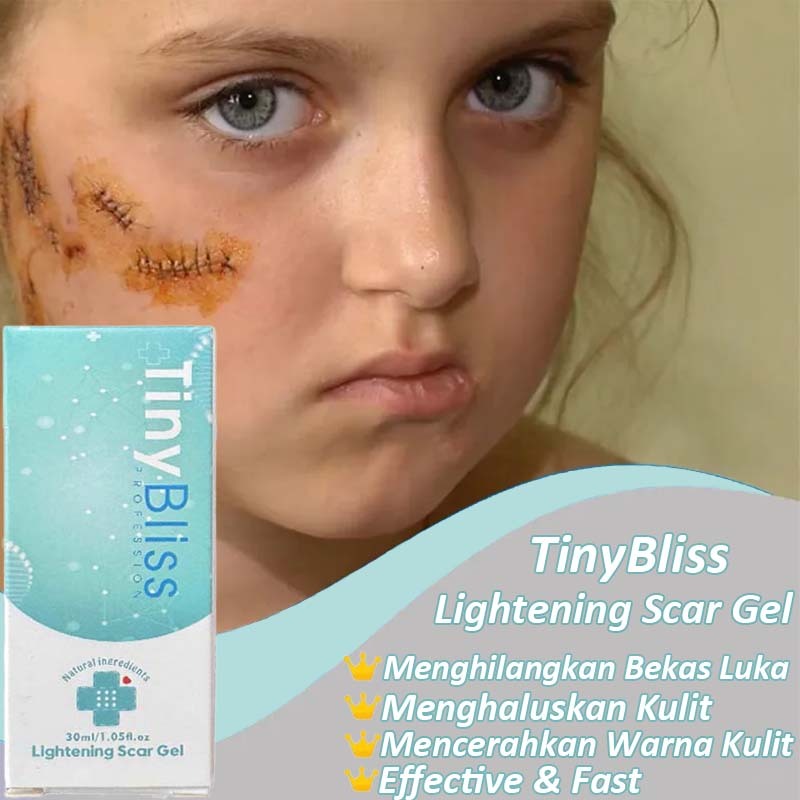 Tiny Bliss Lightening Scar Gel Natural Soothing Gel 30ml Suitable For Old And New Scars On All ...