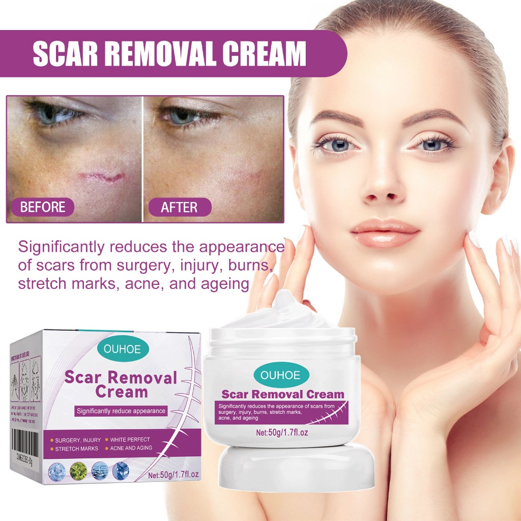 OUHOE Scar Removal Cream 50g Scar Removal Cream Stretch Marks Surgical ...