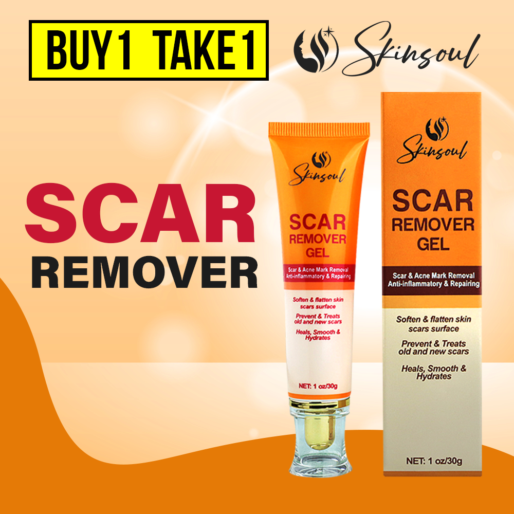 [Buy1 Take1 Today] Skinsoul Scar Removal Cream Original Peklat Acne ...