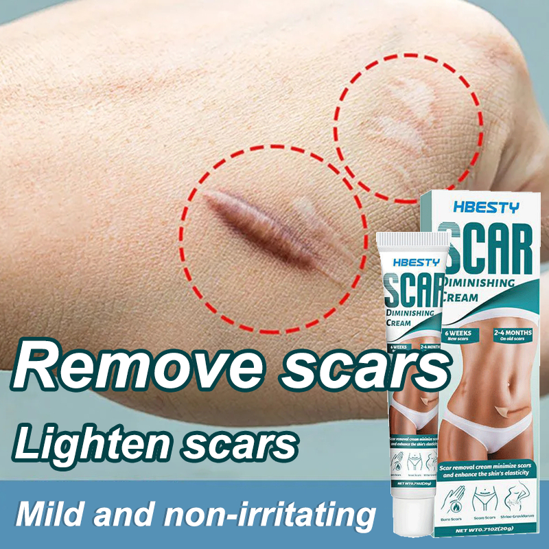 scar cream remover old and hypertrophic scars Gentle texture fast ...