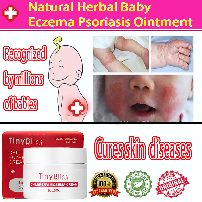 tinybliss baby eczema cream/kamay ni nanay baby rub original/anti itch ...