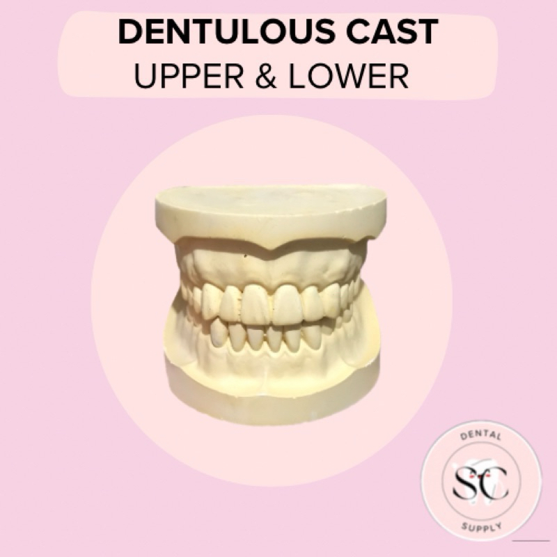 DENTULOUS CAST (UPPER AND LOWER) | Shopee Philippines