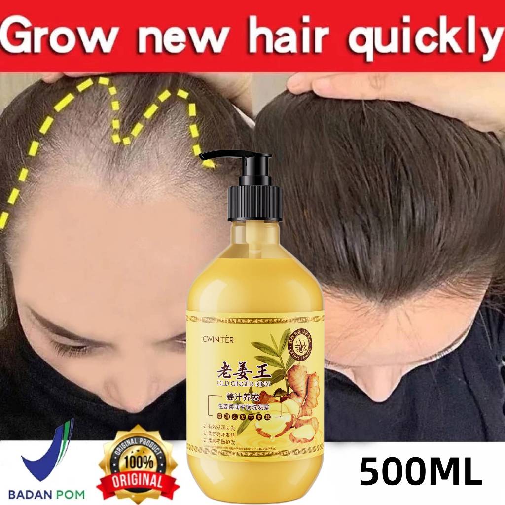 Ginger Hair Shampoo Anti Hair Loss Oil Control Fast Hair Grower ...