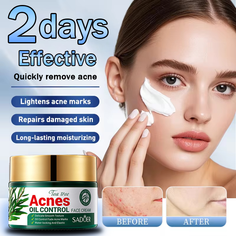 Pimple remover Anti pimples and acne Oil Control Shrink Pores Acne ...