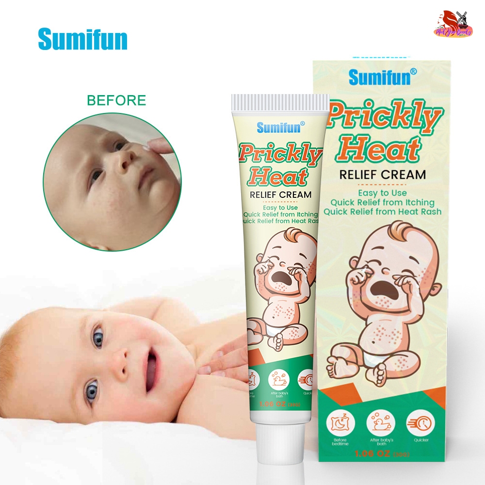 Anti-itch Cream Prickly Heat Ointment Gentle On Skin Herbal Cream For ...