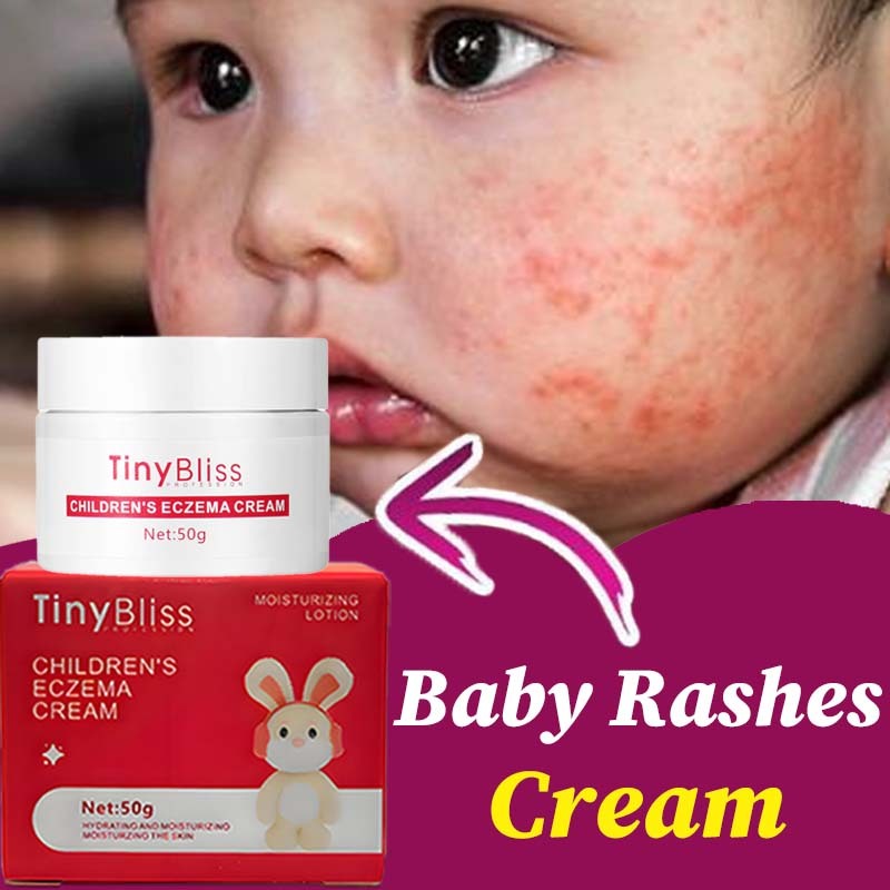 TinyBliss Baby rashes cream eczema cream baby cream Diaperrash creams ...