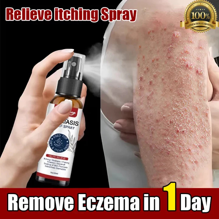 Psoriasis, Head, Skin,Scales,Psoriasis Treatment Serum, Fungus 30g ...