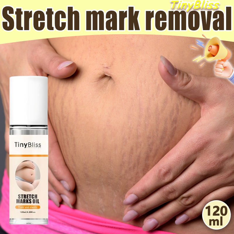TinyBliss stretch mark remover oil120ML Lifting Firming Skin Effects ...