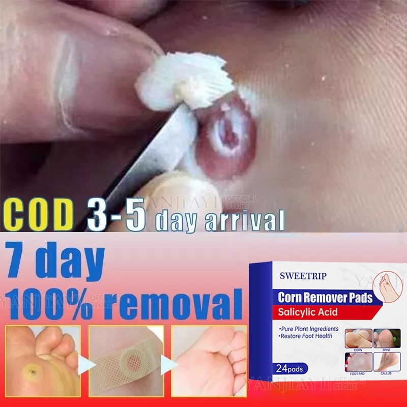 YANJIAYI 24pcs Foot Corns Remover Patch warts remover pad corn and ...