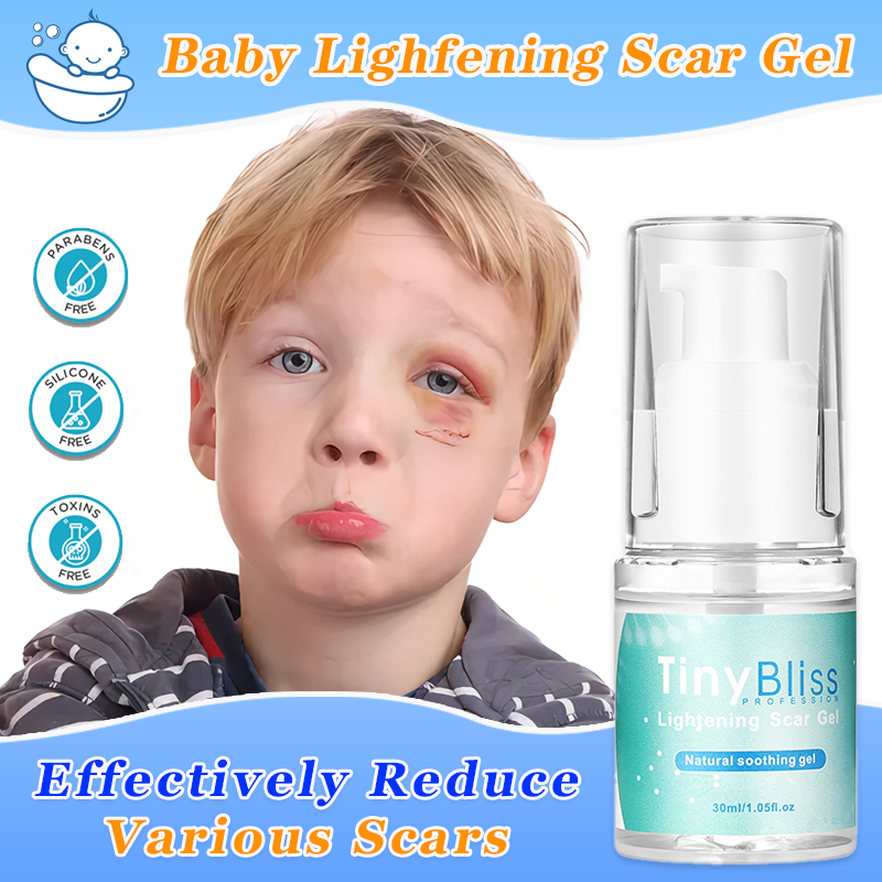 Tiny Bliss 30ML Scar Remover For Kids Mild And Non-Irritating Efficient ...