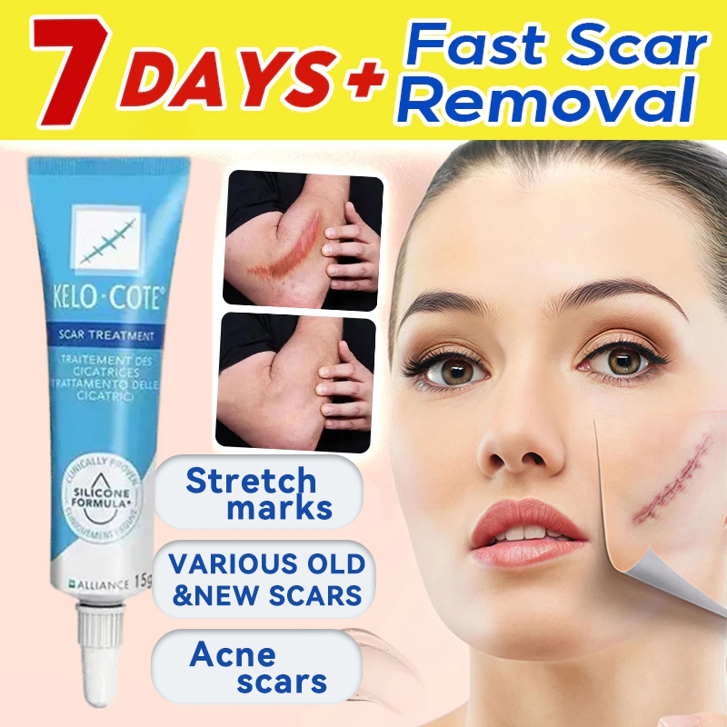 Kelo-Cote Silicone Scar Gel 15g Scar Treatment for Large Burn Scars Scar Remover Cream | Shopee ...