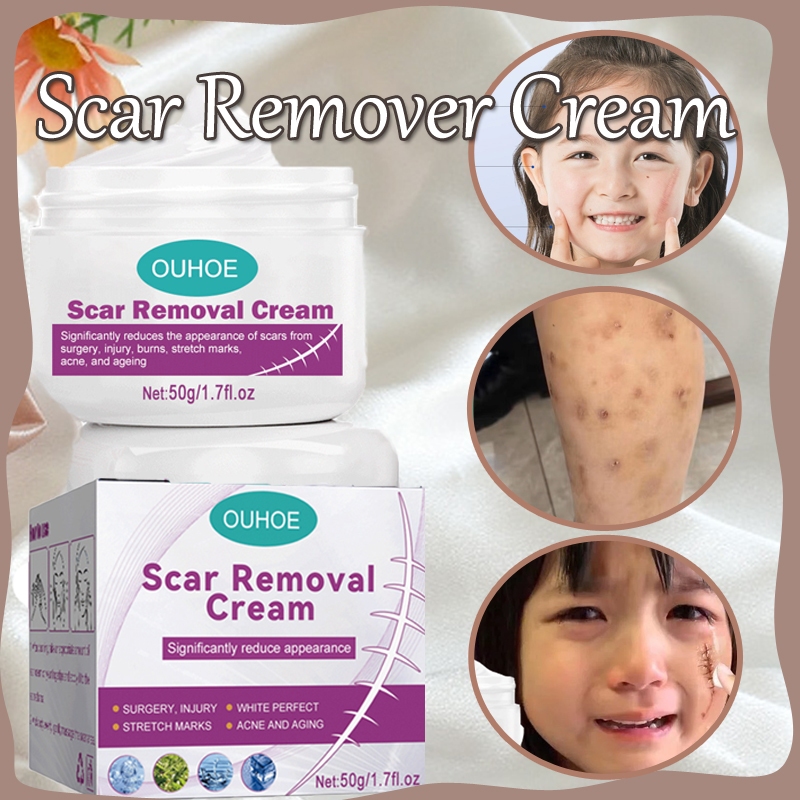 Scar Remover Cream Scar Repair Fade Scald Scar Fade Scars Burns Parut ...