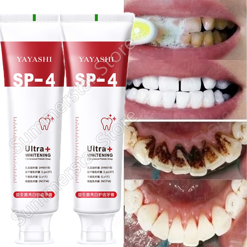 Probiotic Caries Toothpaste SP-4 Whitening Tooth Decay Repair Paste ...
