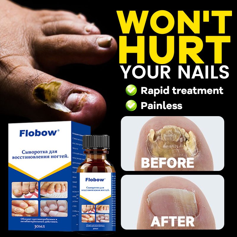 Flobow Inhibit Fungal Nail Infection Fungal Treatment Remove ...