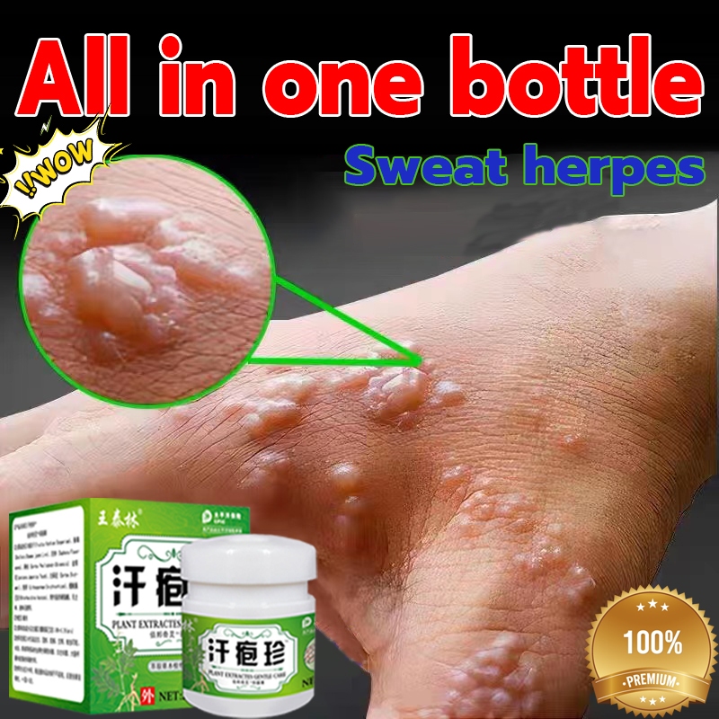 Sweat rash, small blisters on hands and feet, fungal infection, eczema ...
