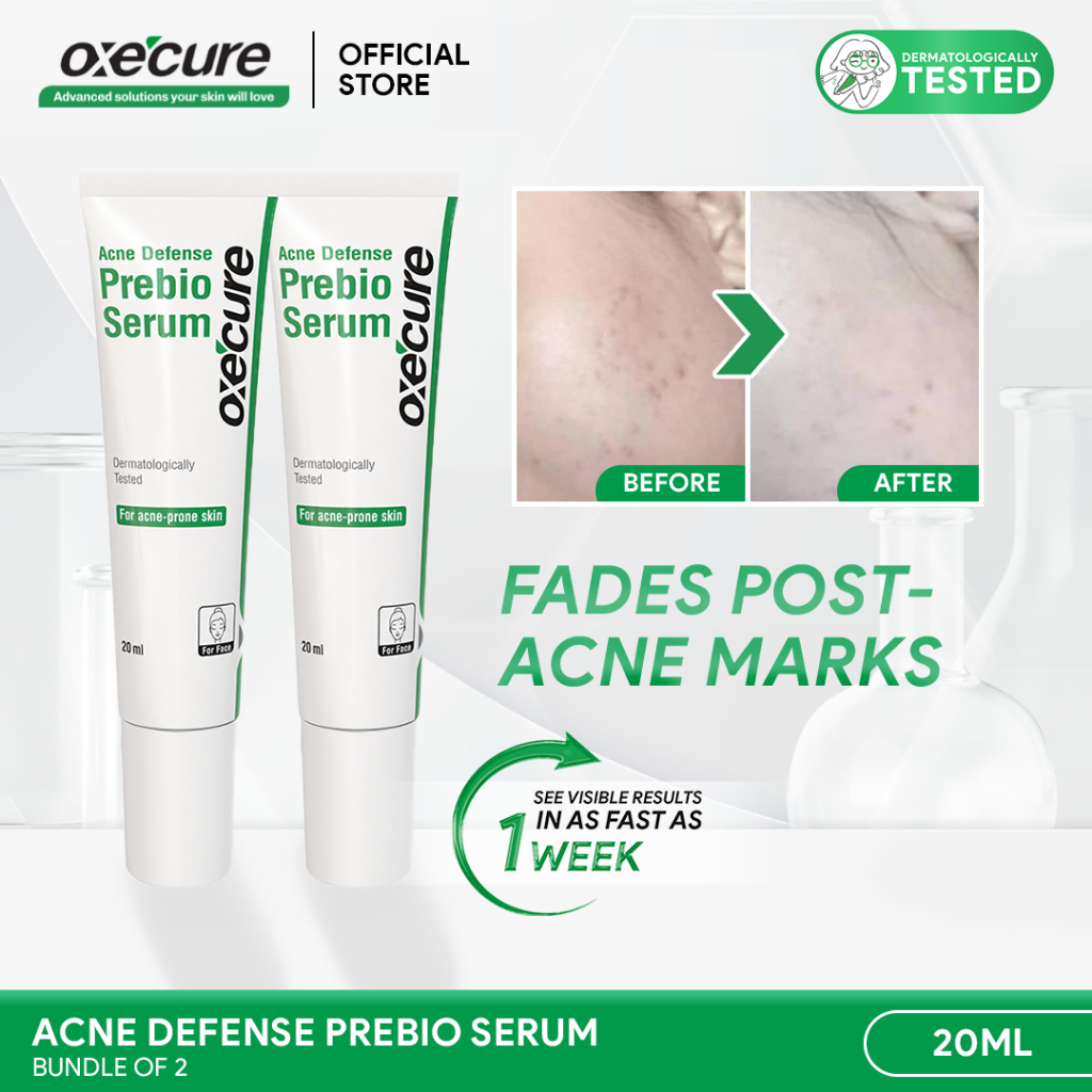 OXECURE Acne Defense Prebio Serum 20ml, Bundle of 2 | Shopee Philippines