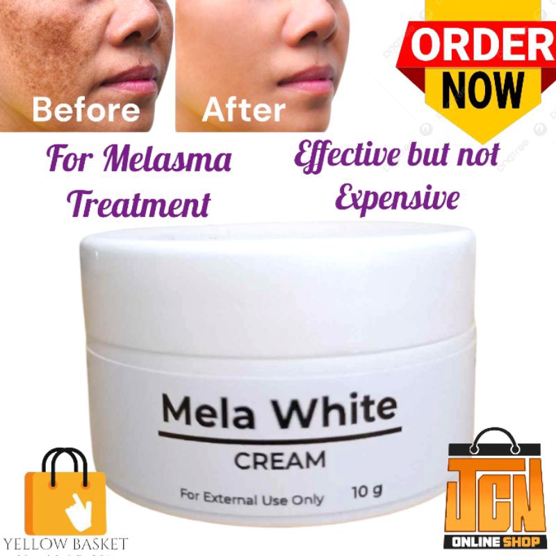 Mela white 10g for melasma treatment skin condition causes brown or ...