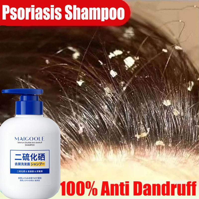 Original Selenium Disulfide Anti-Dandruff Cream for scalp psoriasis ...