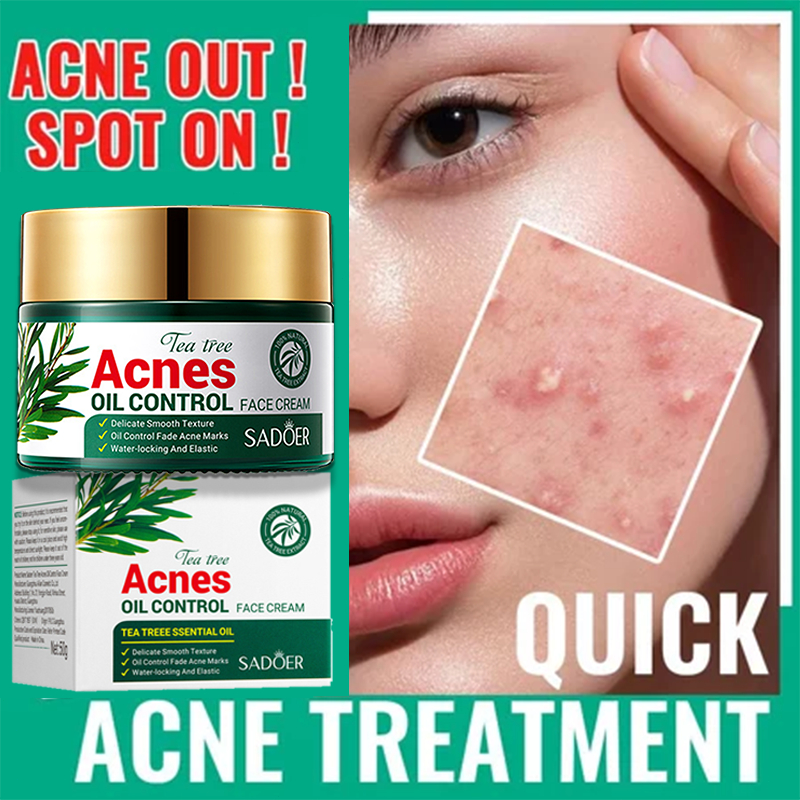60g Acne Scar Remover 100% Effective Restore Skin Fade Acne Scars Pimple Cream Remover | Shopee ...