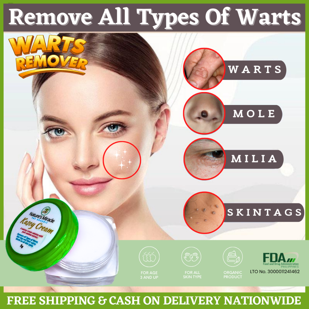 Nature's Miracle Kasoy Cream Original Wart Removal Skin Tag Remover ...