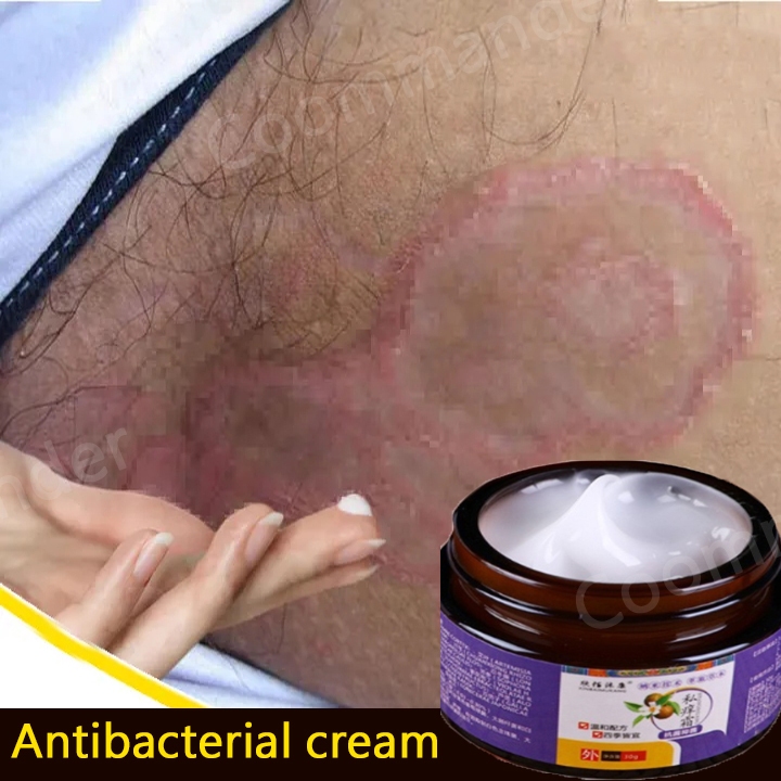 Anti Itch Cream Private Part Antibacterial Cream Herbal Psoriasis ...