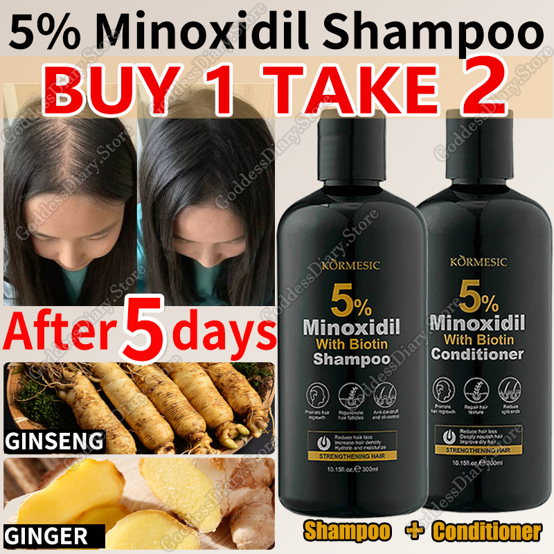 【BUY 1 TAKE 2】Minoxidil 5% Hair Grower Shampoo with Biotin for Hair ...