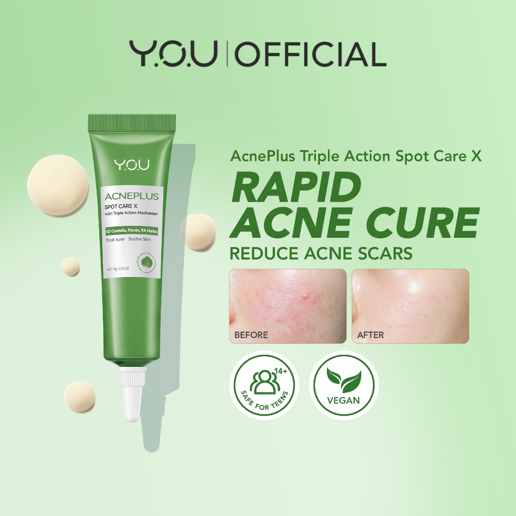 Y.O.U AcnePlus Triple Action Spot Care X | Acne Treatment | Calm ...