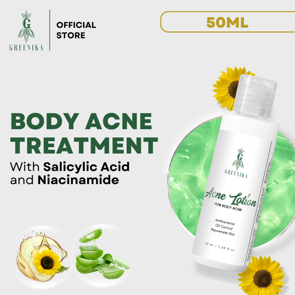 [ ACNE REMOVAL LOTION ] Greenika Acne Lotion For Bacne Arms Back Body ...