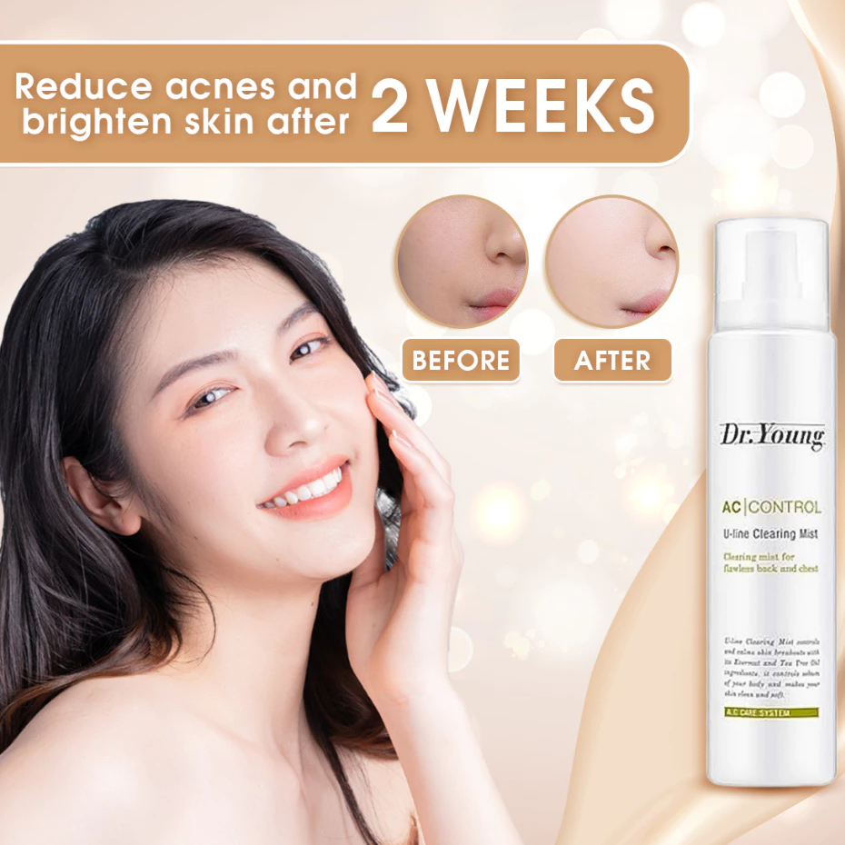 Dr.Young Uline Clearing Mist Helps Control Acne, Soothe and Moisturize ...