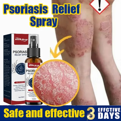 South Moon Psoriasis Relief Spray 30ml Hand Foot Scalp Eczema Tinea ...