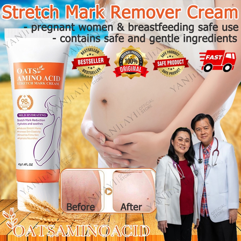 Stretch Mark Remover Cream Mild Oats Amino Acid Safe Remove Stretch ...