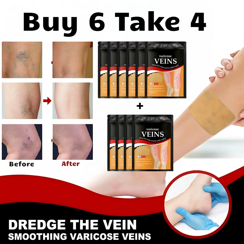[Buy 6 Take 4] Varicose Vein Remover Patch Effective Muscular Pain ...