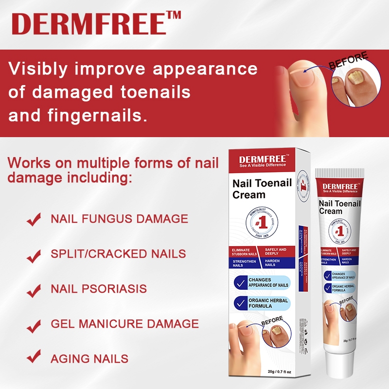 DERMFREE Anti Paronychia Relief Oil Ingrown Toenail Anti Fungal Toe ...