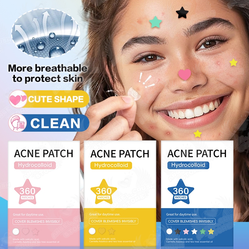 360Pcs Acne Pimples Patches Hydrocolloid Colorful Suitable All Skin ...