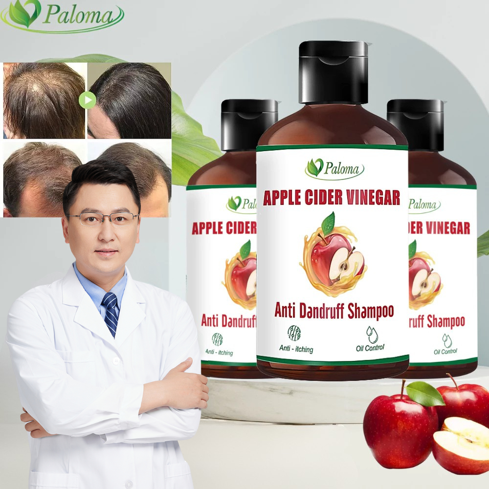 Paloma Apple Cider Vinegar Shampoo Anti Dandruff Shampoo Anti-itching ...
