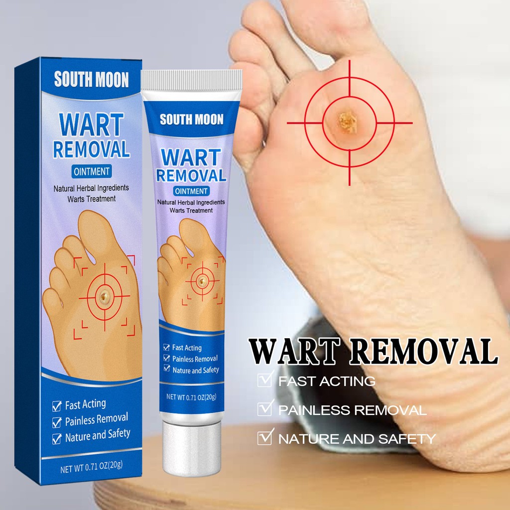 South Moon Callus Remover Cream Flat Wart Removal Cream for Plantar ...