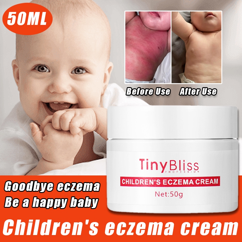 TinyBliss Rashes Cream For Baby Relieve The Pain Of Eczema In Children ...