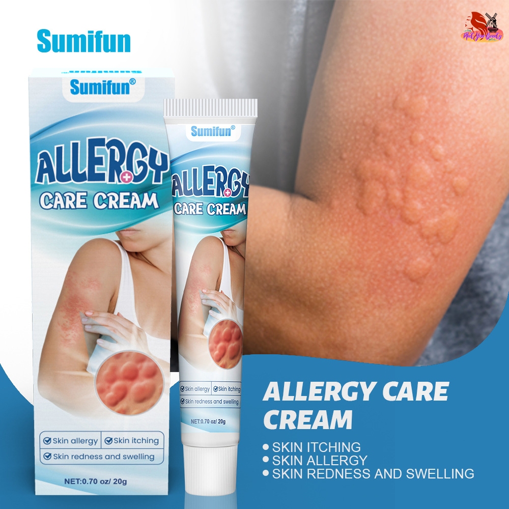 Allergy Soothing Cream 20g for Sensitive Skin Relieve Itching and ...