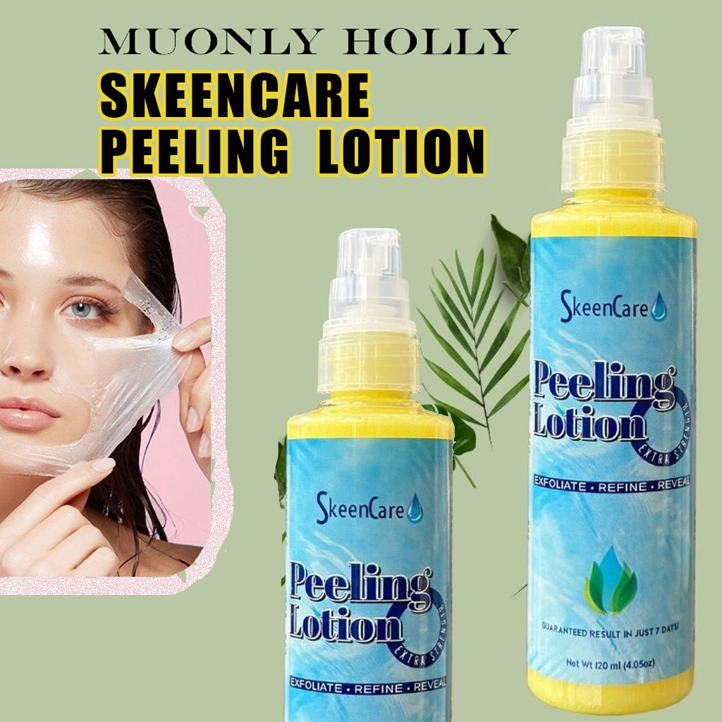 Viki Skin Peeling Lotion 100ml Renew Dead Skin For Face and Body ...