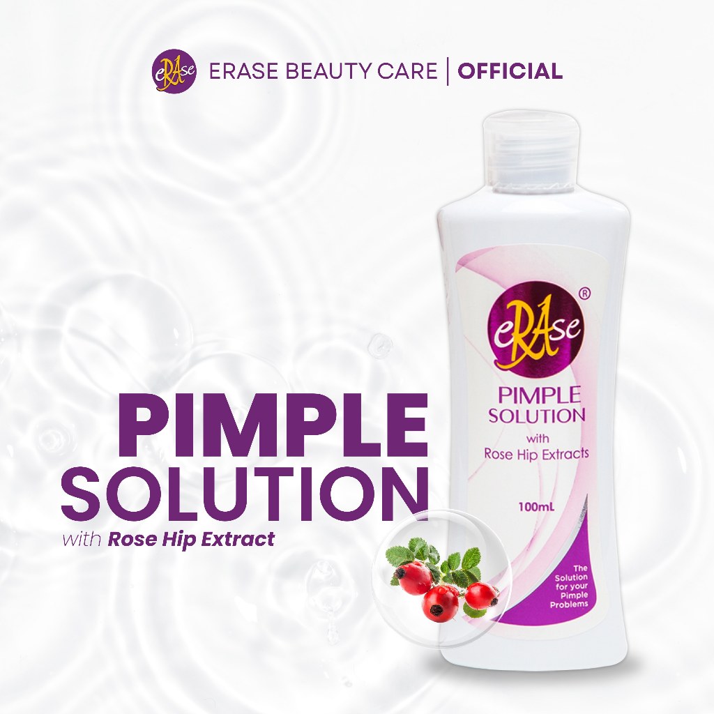 Erase Pimple Solution | Shopee Philippines