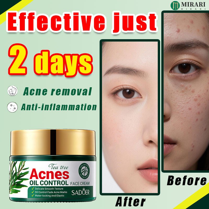 Effective in 1 week pimple acne remover improves acne remover acne ...