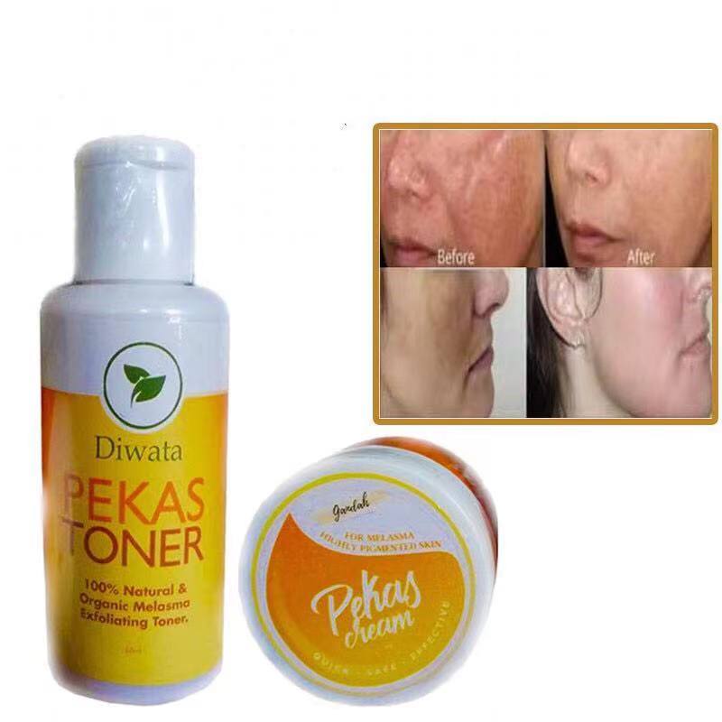 2in1 ORIGINAL Diwata Pekas Toner + Pekas Cream | Shopee Philippines