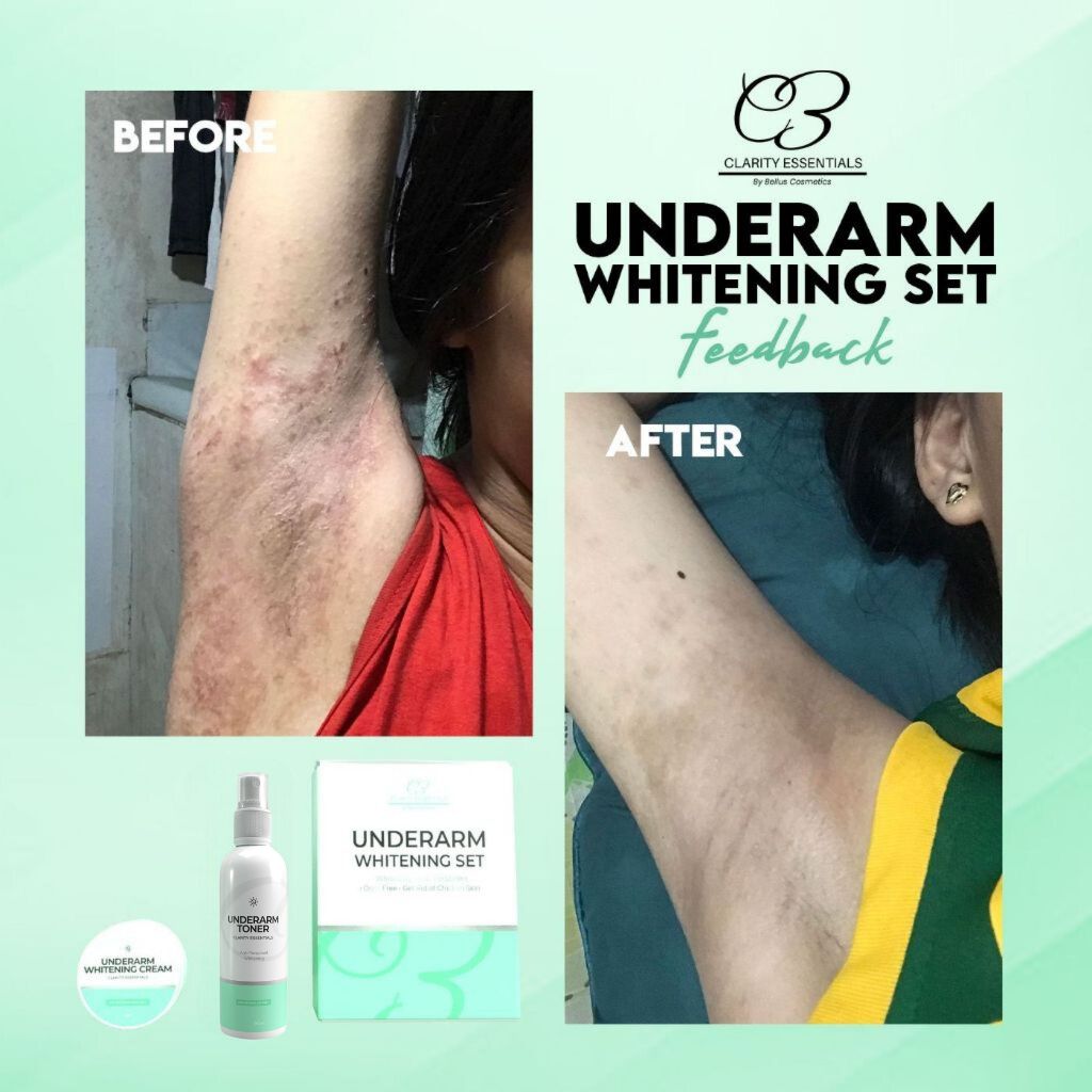 Underarm Whitening by Clarity Essentials - Underarm Whitening Toner ...