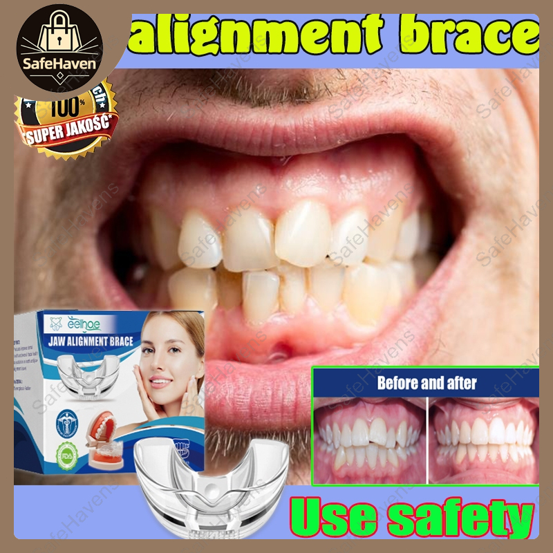 SafeHavens Dental Orthodontic Appliance Teeth Alignment Teeth Aligner ...
