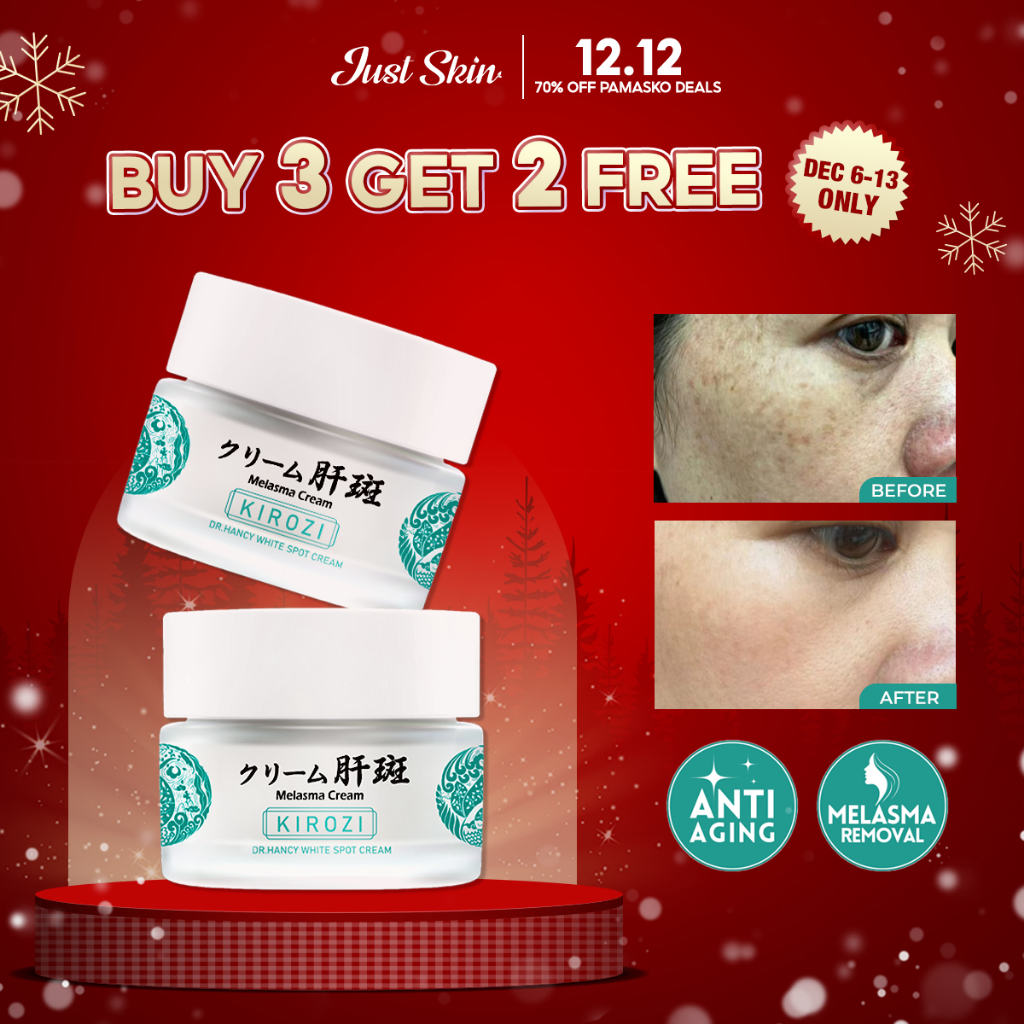 Japanese Kirozi Melasma Cream - Pekas Remover Effective Anti-Freckle ...