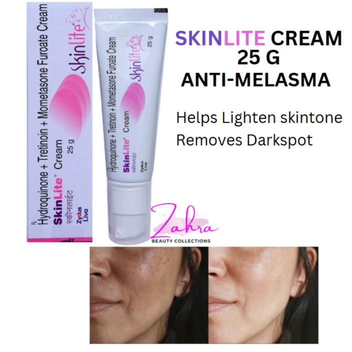 Skinlite Cream 25g anti melasma | Shopee Philippines