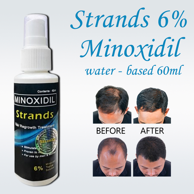 Original Minoxidil Hair Grower 60ml – 6% Formula for Thicker Hair ...